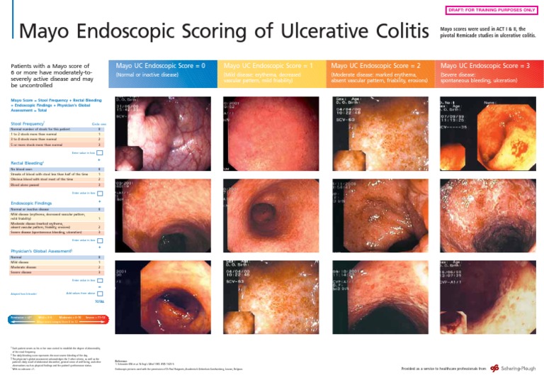 Mayo Endoscopic Scoring for UC | PDF