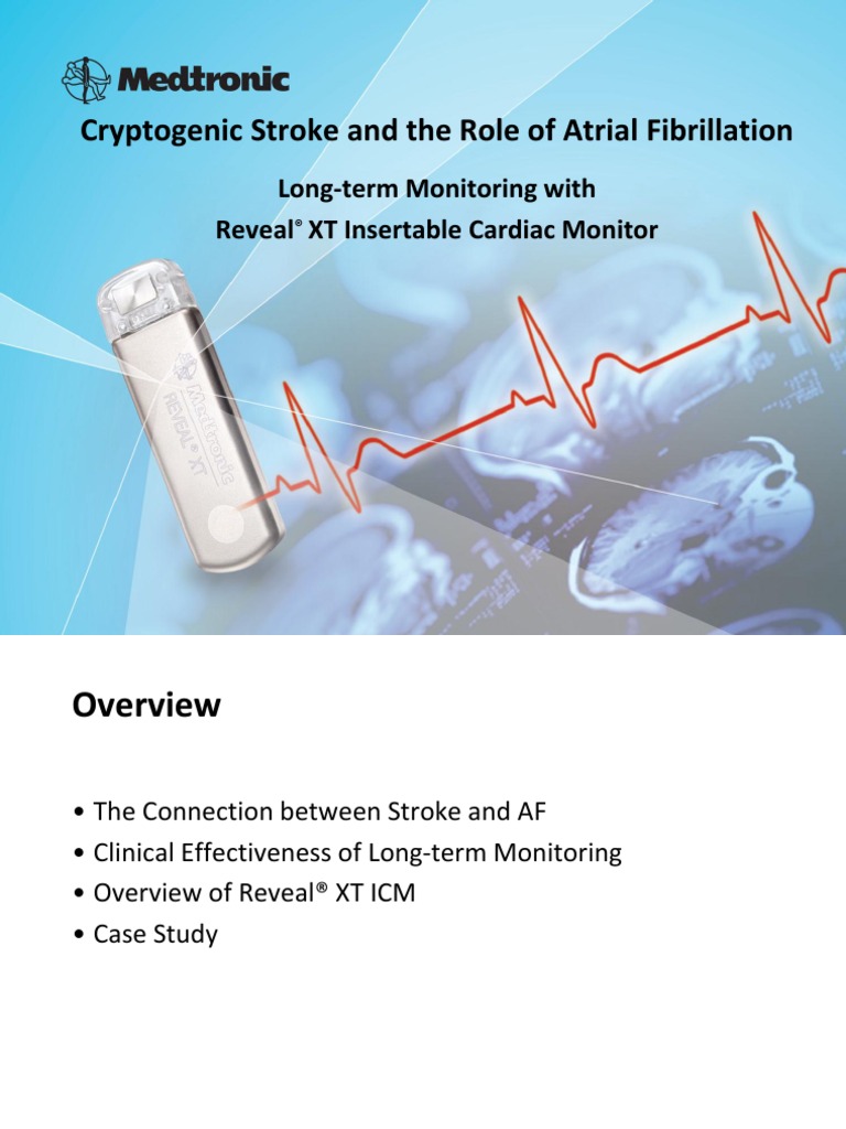 Cryptogenic Stroke and The Role of Atrial Fibrillation: Long-Term ...