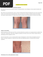 GM Steroid Ladder | PDF | Topical Medication | Corticosteroid
