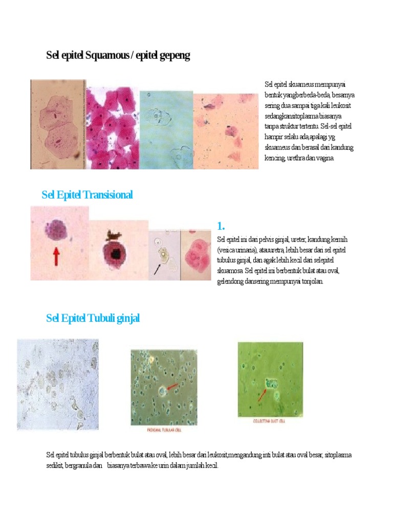 Atlas Sedimen Urin | PDF