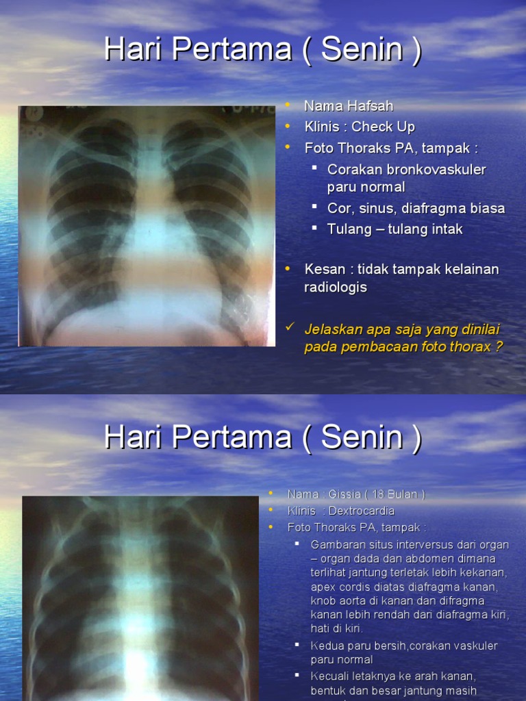 Belajar Membaca Radiologi | PDF