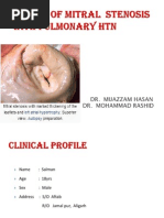 ROB2 Excel Instruction v7 | PDF | Microsoft Excel | Risk