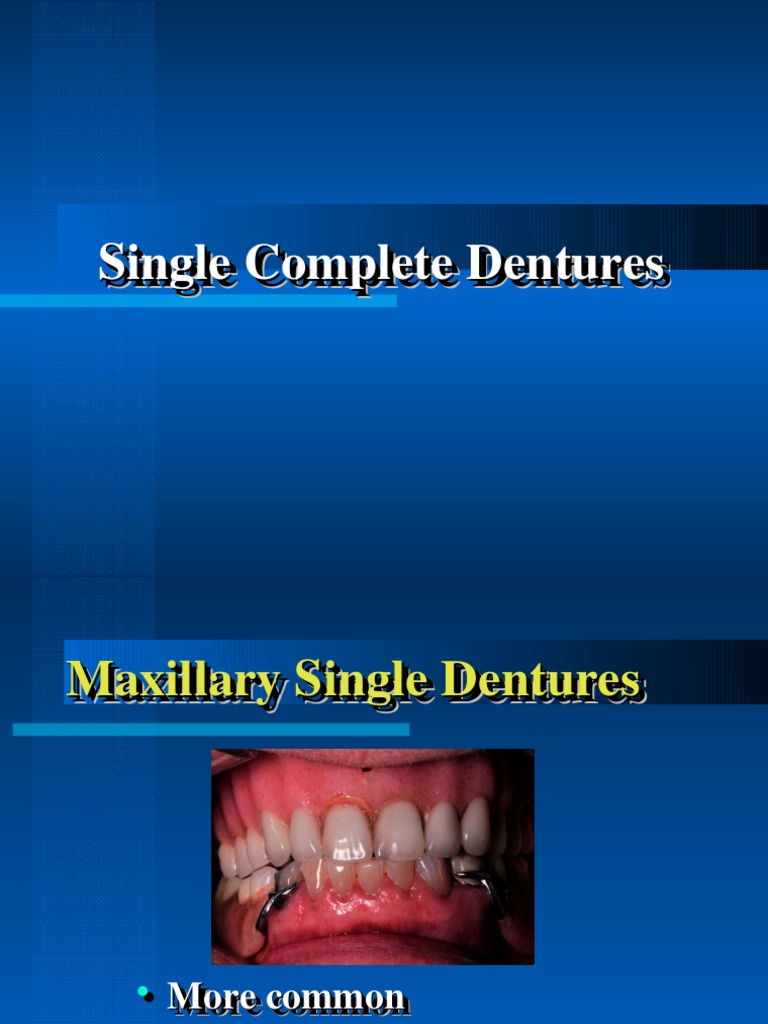 Single Complete Denture | Dentures | Dentistry Branches