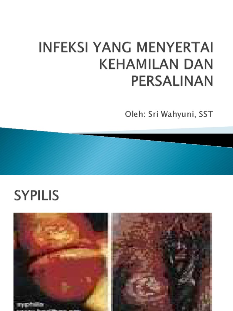 Infeksi Yang Menyertai Kehamilan Dan Persalinan | PDF