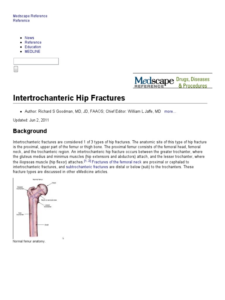 Intertrochanteric Hip Fractures PDF | PDF | Orthopedic Surgery | Hip