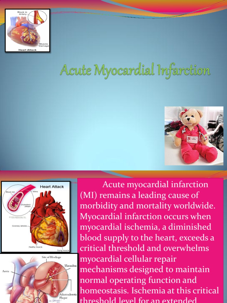 Acute Myocardial Infarction | PDF | Atrium (Heart) | Angina Pectoris