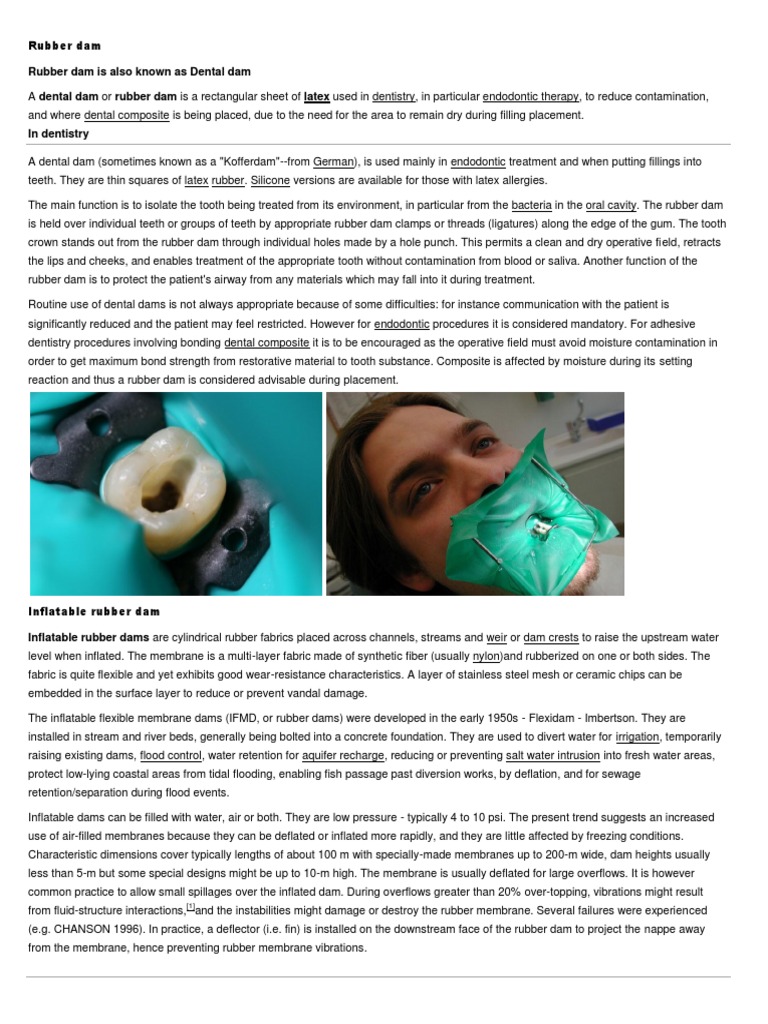 Isolating Teeth for Dental Procedures: Rubber Dams and Their Uses in ...