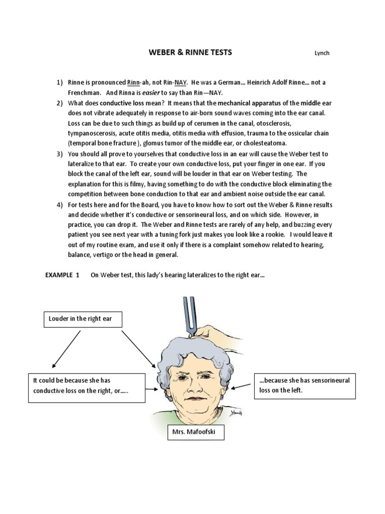 WEBER & Rinne Tests | PDF | Hearing | Human Head And Neck