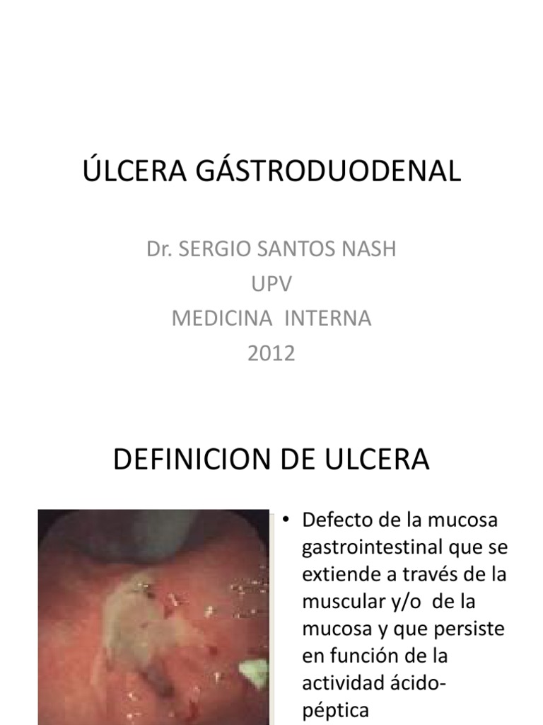 Ulcera Gastroduodenal 5 Úlcera Péptica Especialidades Medicas