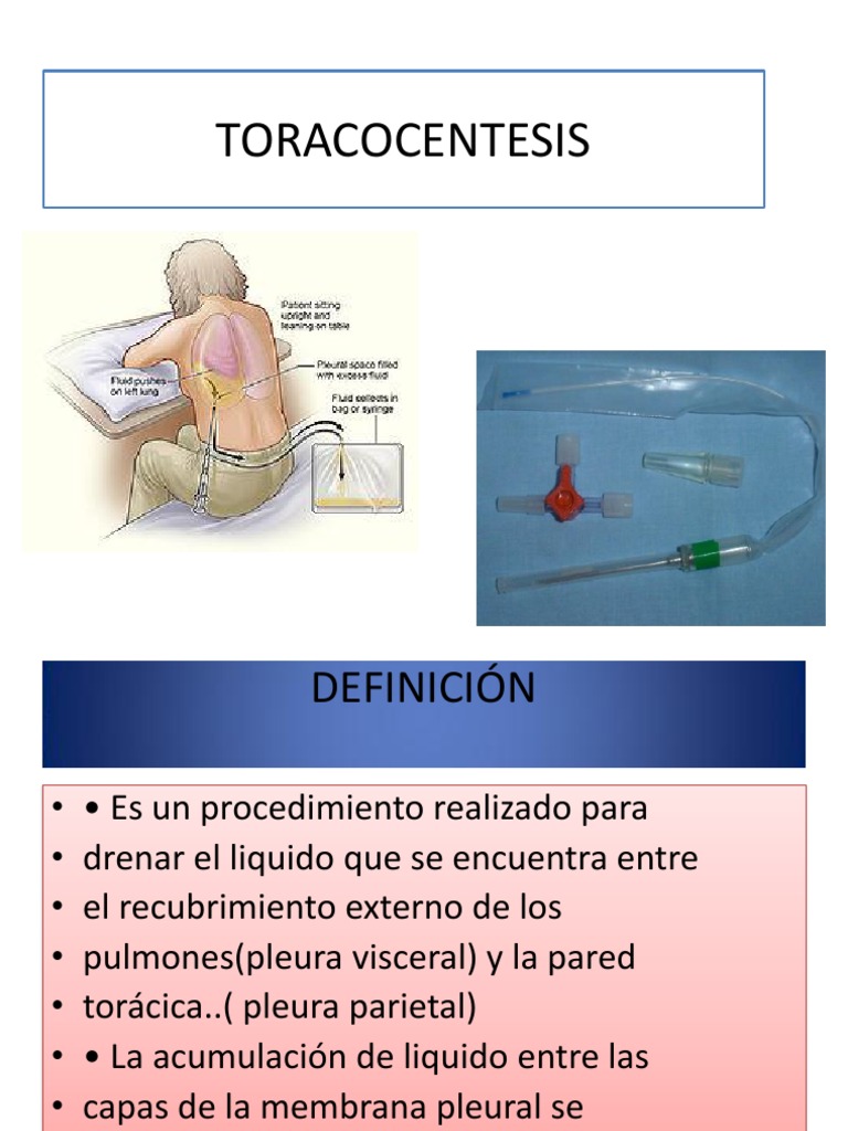 TORACOCENTESIS11 | PDF | Especialidades Medicas | Medicina CLINICA