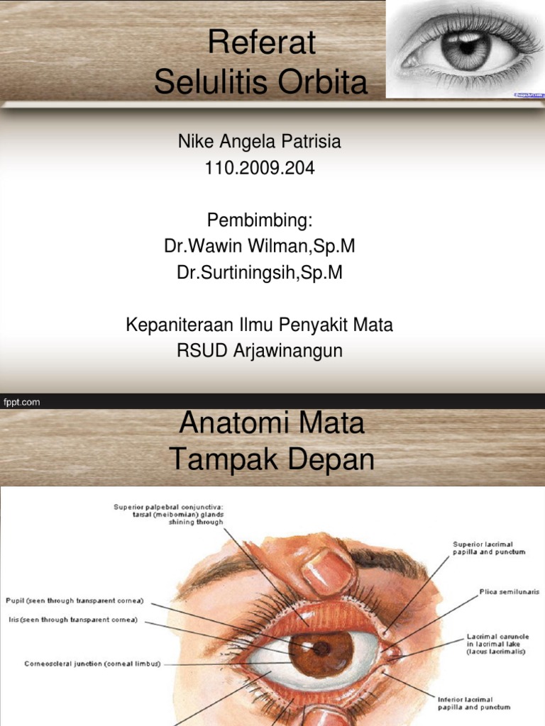 Selulitis Orbita | PDF