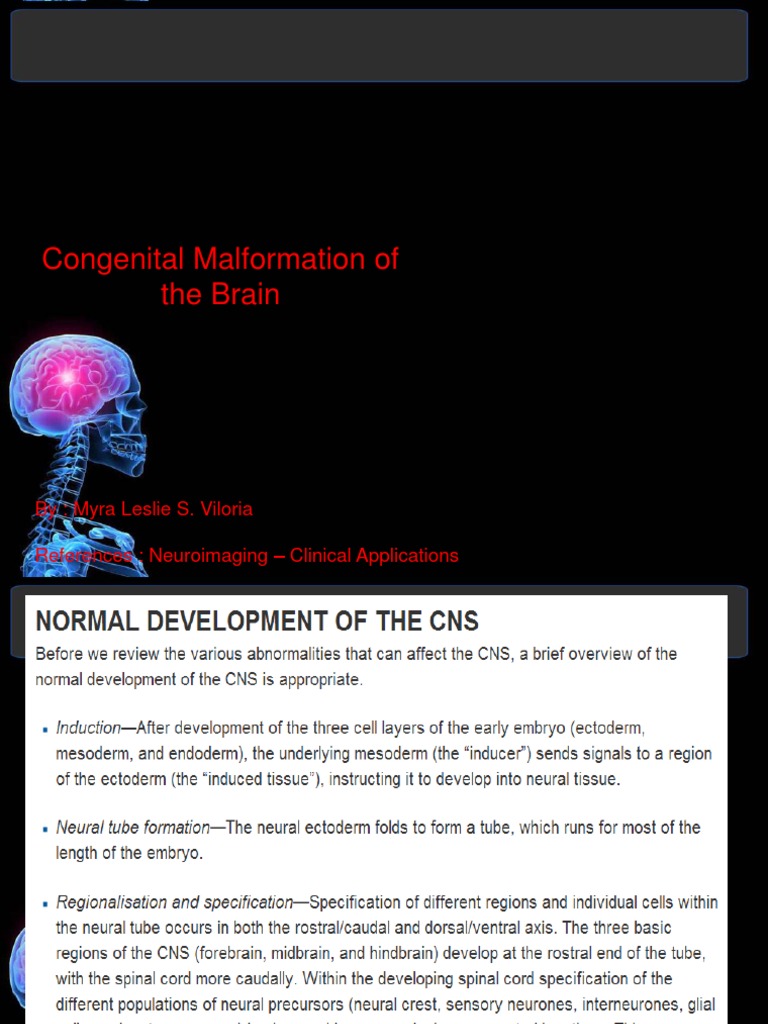 Congenital Malformation of The Brain: By: Myra Leslie S. Viloria ...