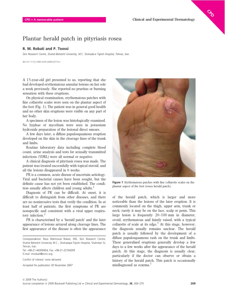 Plantar Herald Patch in Pityriasis Rosea | PDF | Cutaneous Conditions ...
