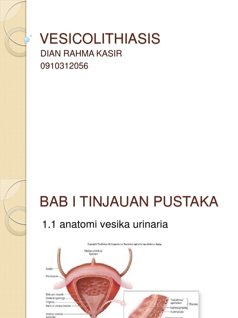 VESICOLITHIASIS | PDF