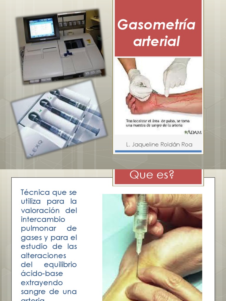 técnica gasometria