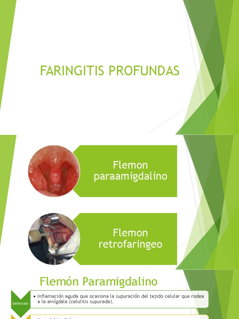 Faringitis Agudas y Cronicas | PDF | Tos | Especialidades Medicas