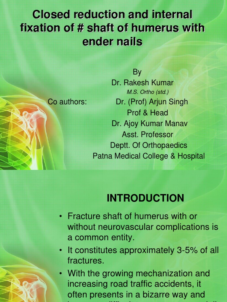 Ender Nailing in Humerus | PDF | Shoulder | Elbow