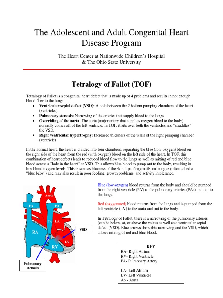 TOF Patient Education | Cardiac Arrhythmia | Heart