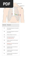 Ecg Interpretation J Point Stemi Criteria Equivalents and Others | PDF ...