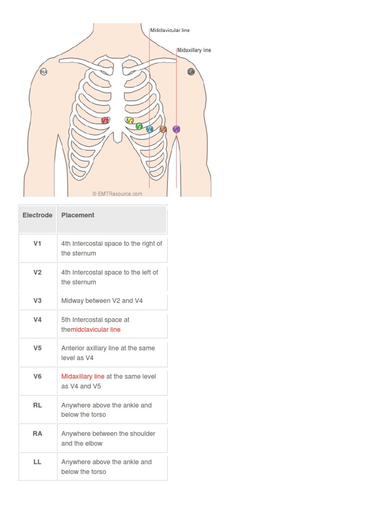 Electrode Placement: Midclavicular Line | PDF | Electrocardiography ...