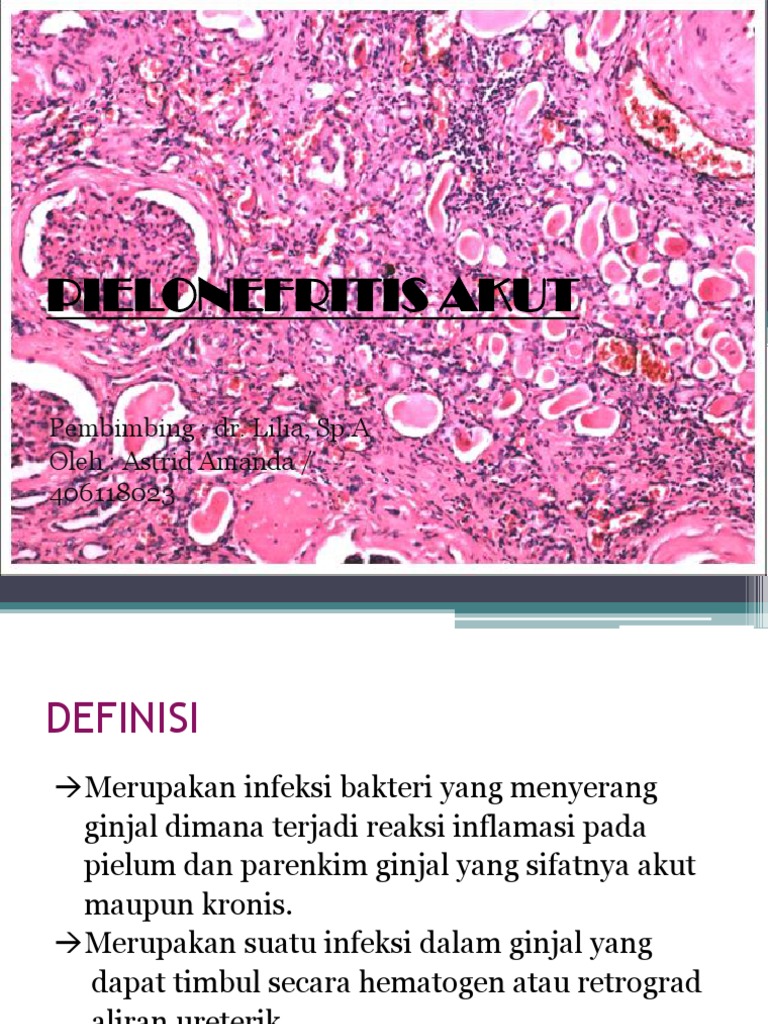 Pielonefritis Akut | PDF | Ilmu Sosial | Kesehatan Holistik