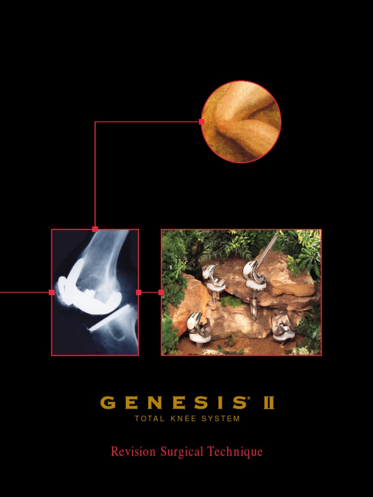 Genesis II Revision Surgical Technique | PDF | Sterilization ...