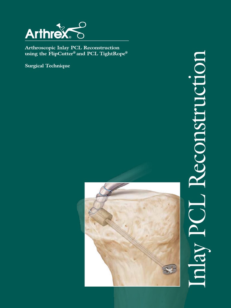Arthroscopic Inlay PCL Reconstruction Using the FlipCutter and PCL TightRope | Anatomical Terms ...