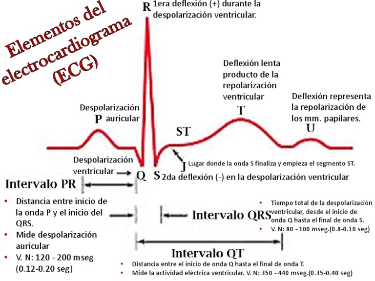 Elementos ECG