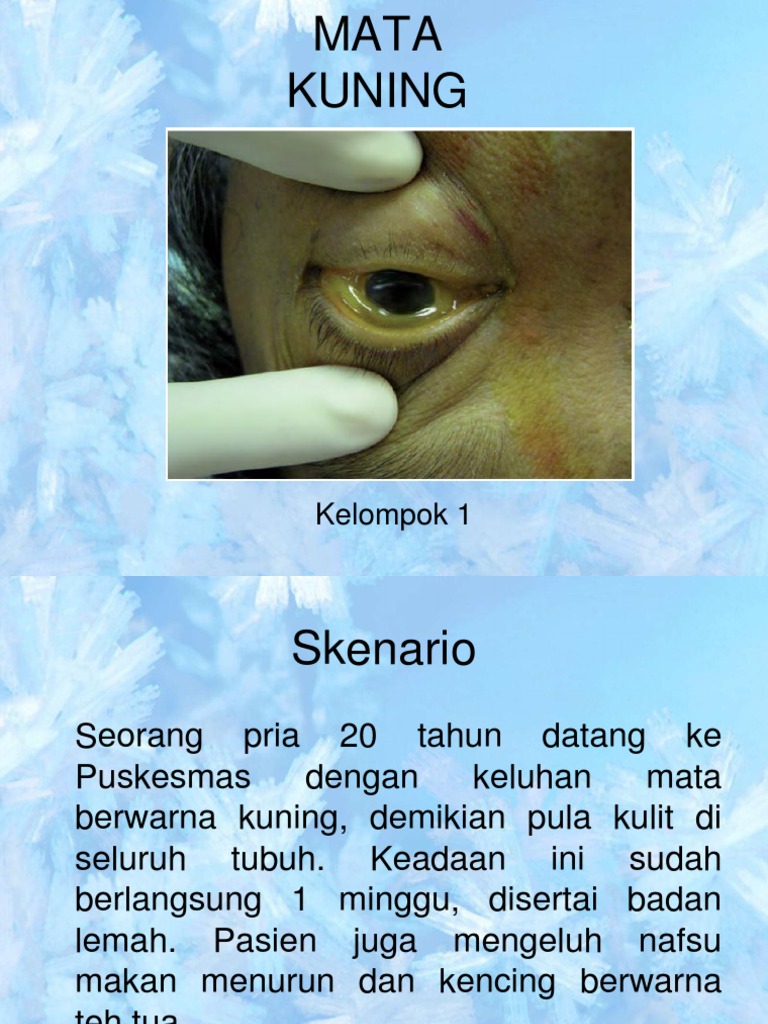 Mata Kuning | PDF | Memasak, Makanan, & Anggur | Kesehatan Holistik