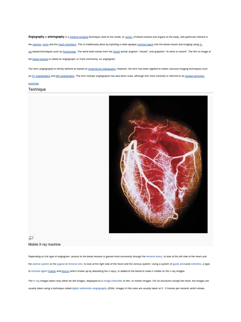 Angiography | PDF | Angiography | Angiology