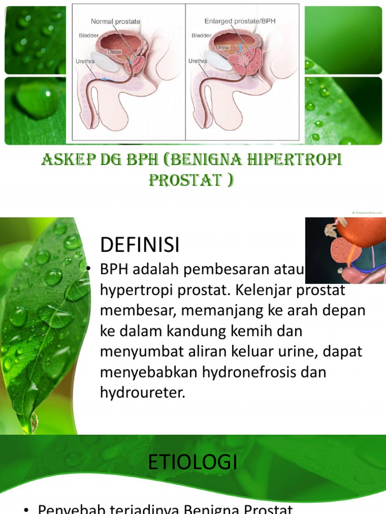 Askep DG BPH (Benigna Hipertropi Prostat) | PDF