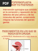 Colporrafia Anterior y Posterior | PDF | Vagina | Medicina CLINICA