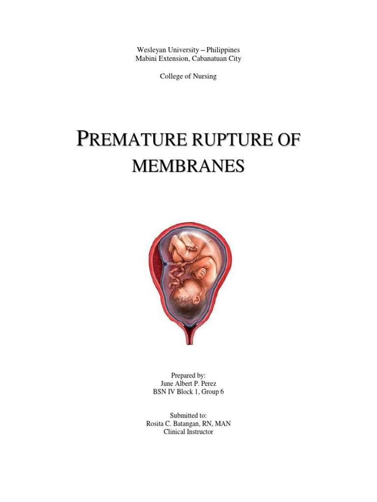 Premature Rupture of Membranes | Preterm Birth | Childbirth