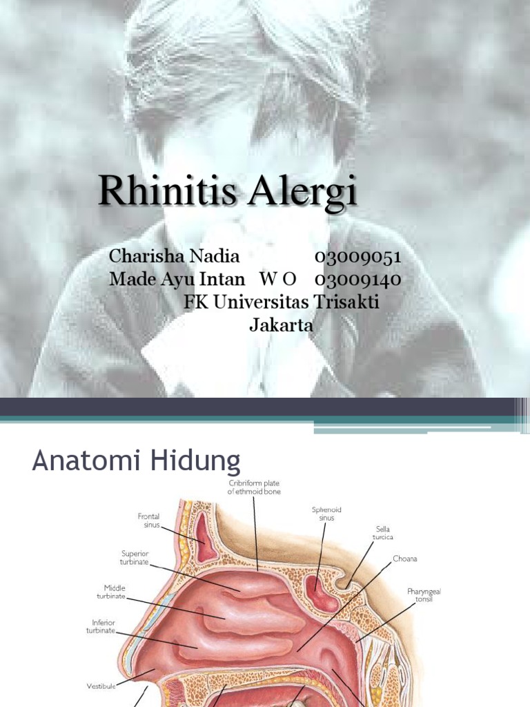 Rhinitis Alergi | PDF