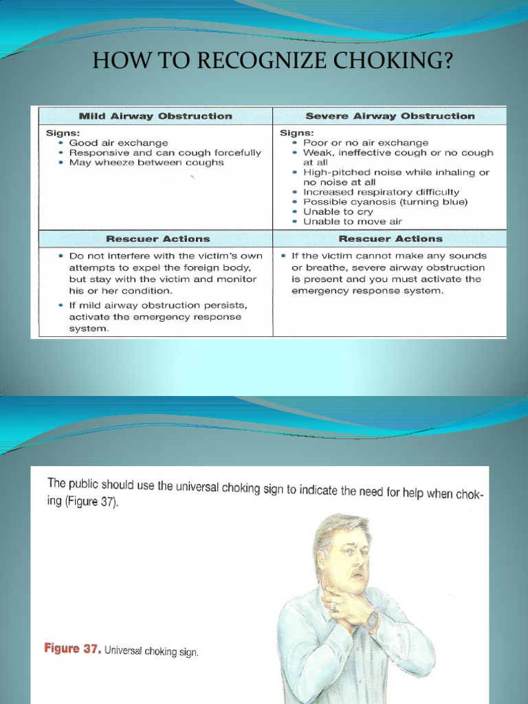 How To Recognize Choking? | PDF