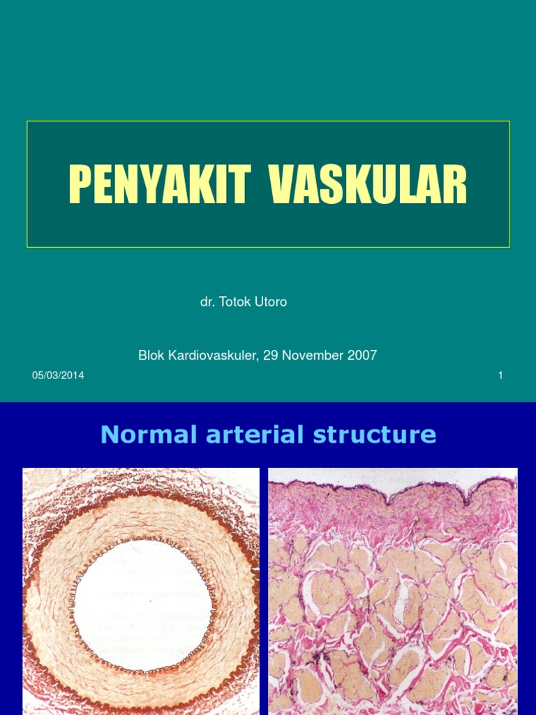 Penyakit Vaskular | PDF
