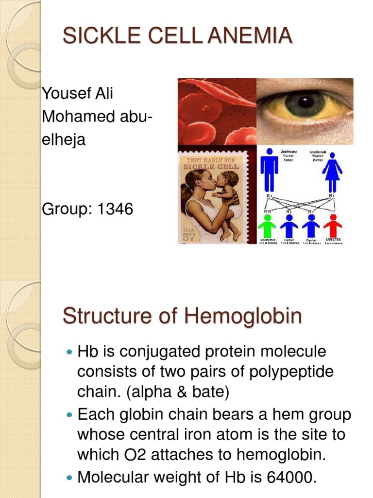Sickle Cell Anemia: Yousef Ali Mohamed Abu-Elheja | PDF | Sickle Cell ...