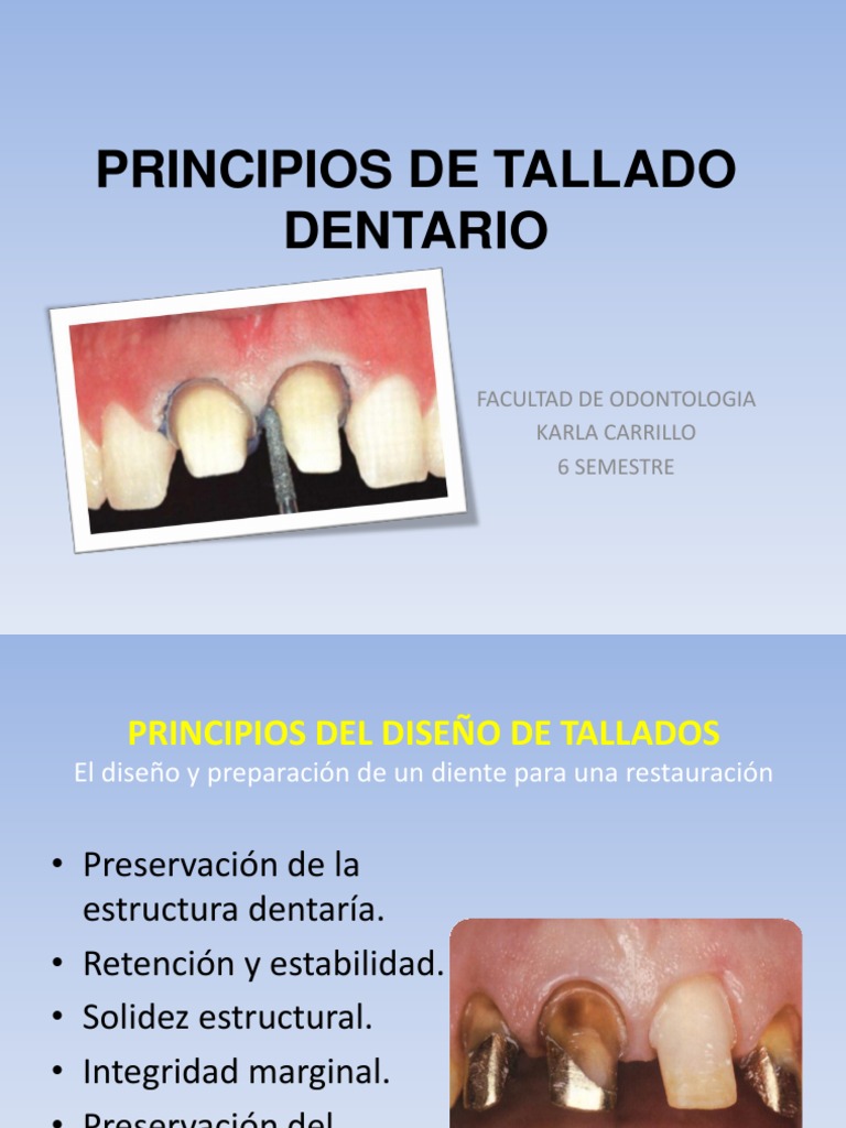 Principios de Tallado Dentario Karla Expo | Diente humano | Dentadura ...