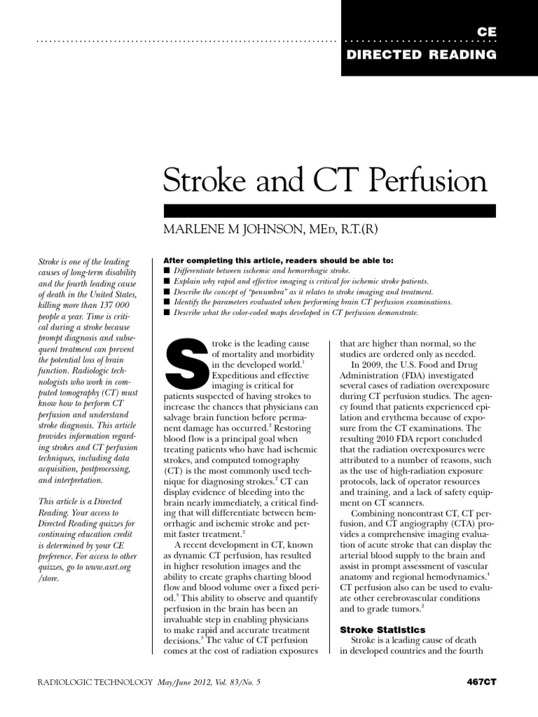 Stroke and CT Perfusion | PDF | Stroke | Ischemia