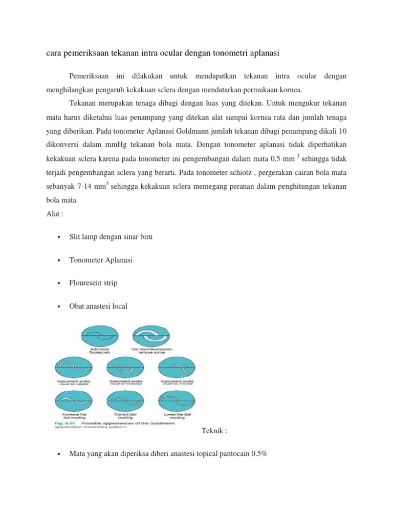 Cara Pemeriksaan Tekanan Intra Ocular Dengan Tonometri Aplanasi | PDF ...