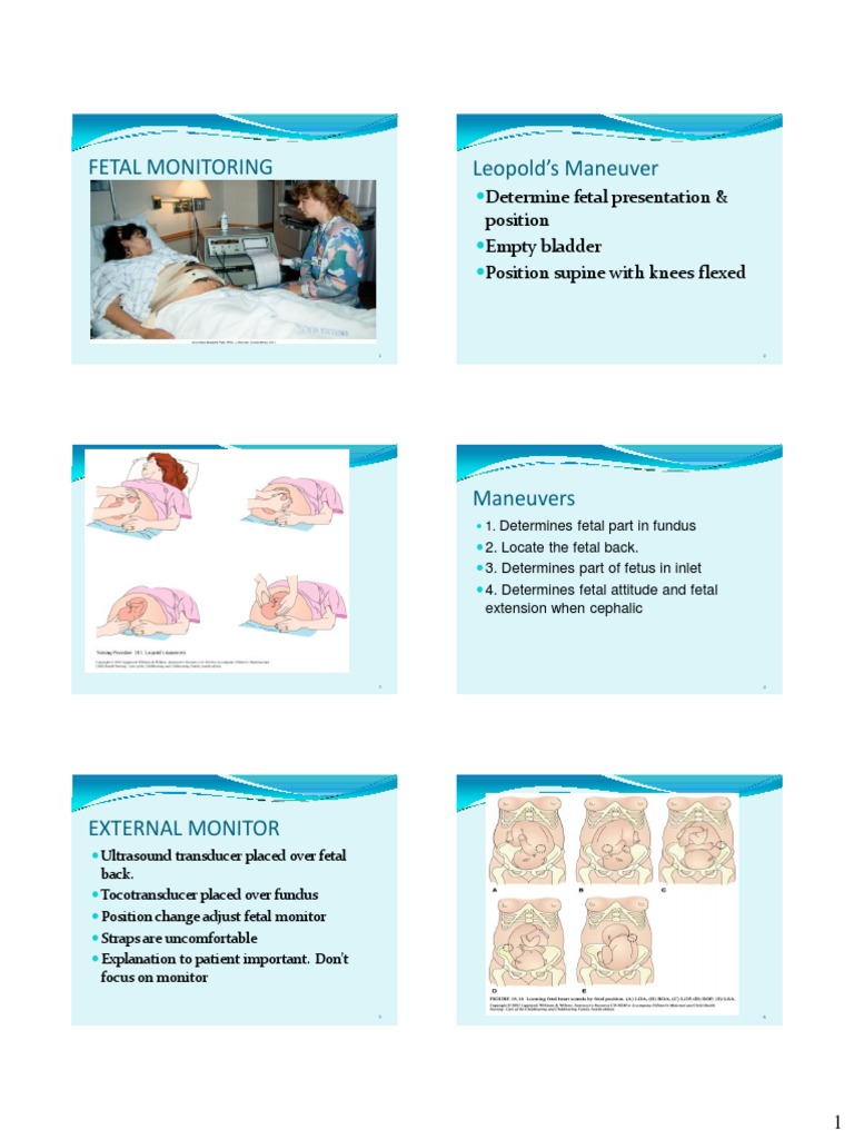 Interpreting Fetal Heart Rate Patterns and Monitoring Techniques During ...