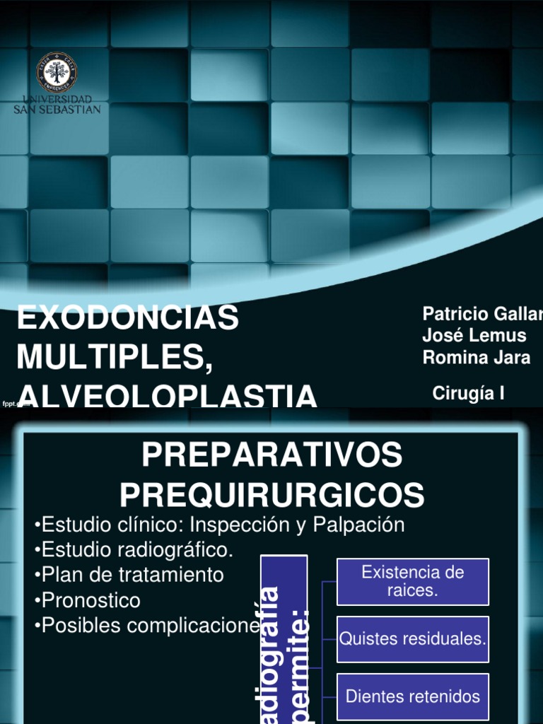 Alveoloplastia y Extracciones Múltiples | PDF | Cirugía | Dentadura postiza