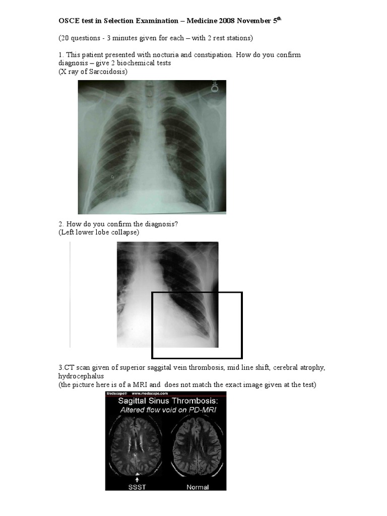 OSCE Test in Selection Examination - Medicine 2008 November 5 | PDF ...