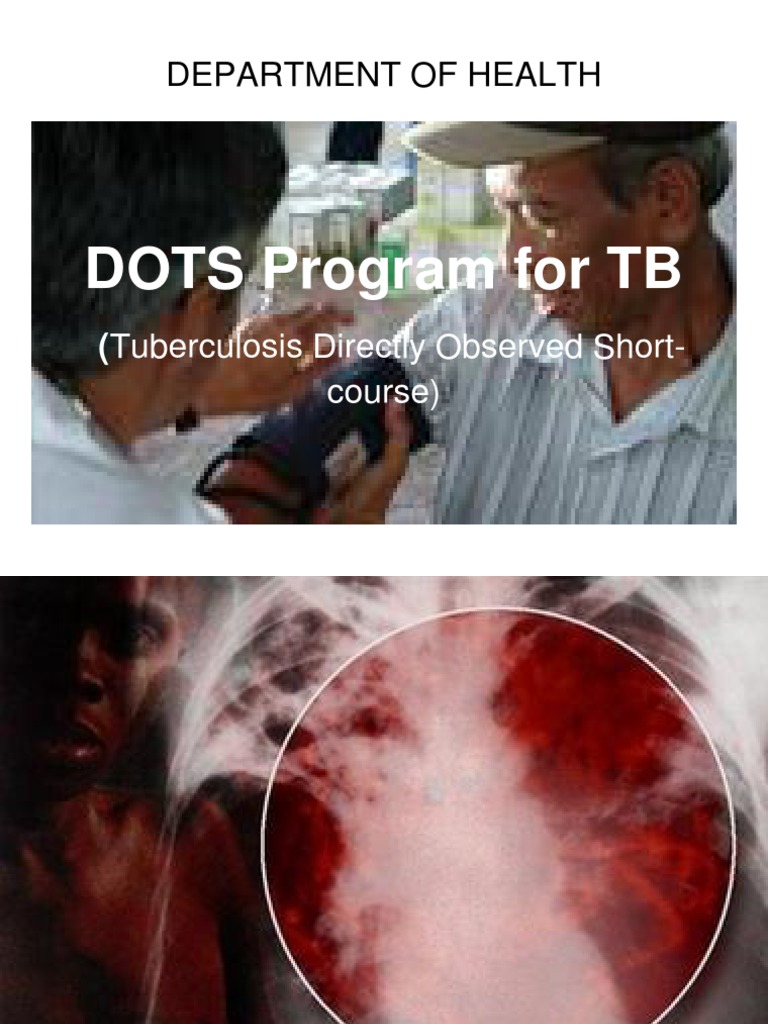 DOTS Program: Effective TB Control Strategy | PDF