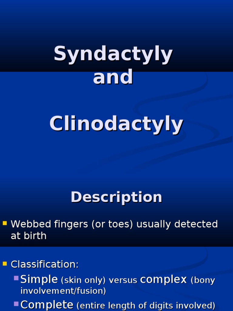 Syndactyly and Clinodactyly | PDF | Surgery | Medicine