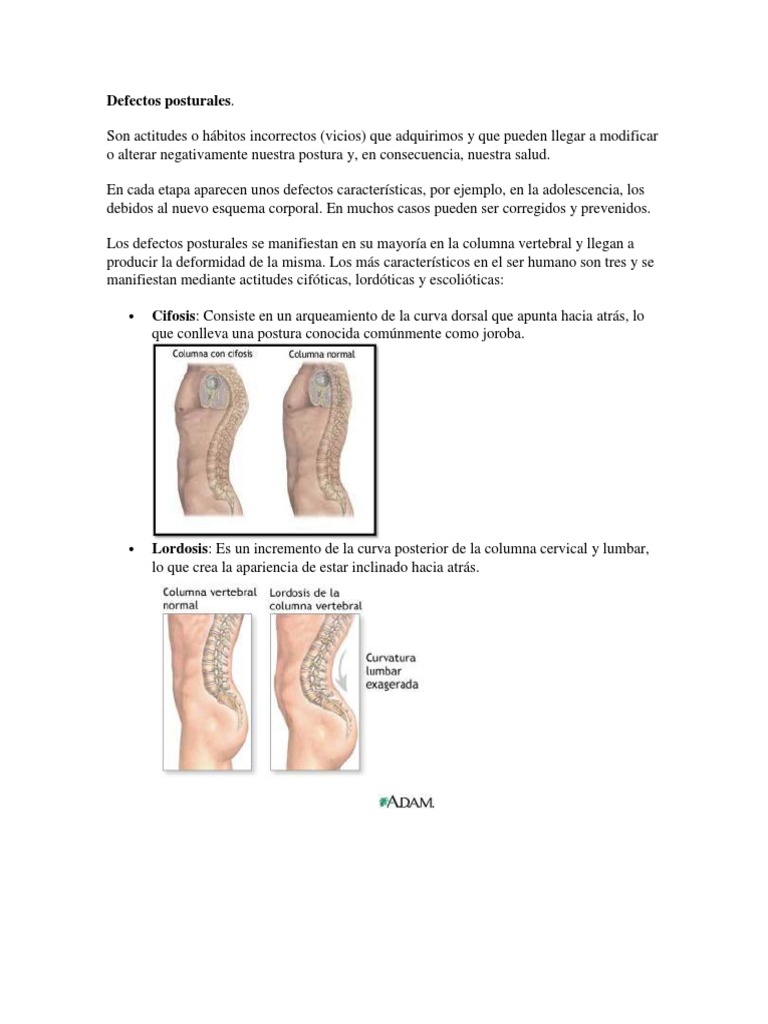 Defectos Posturales | PDF | La columna vertebral | Rodilla