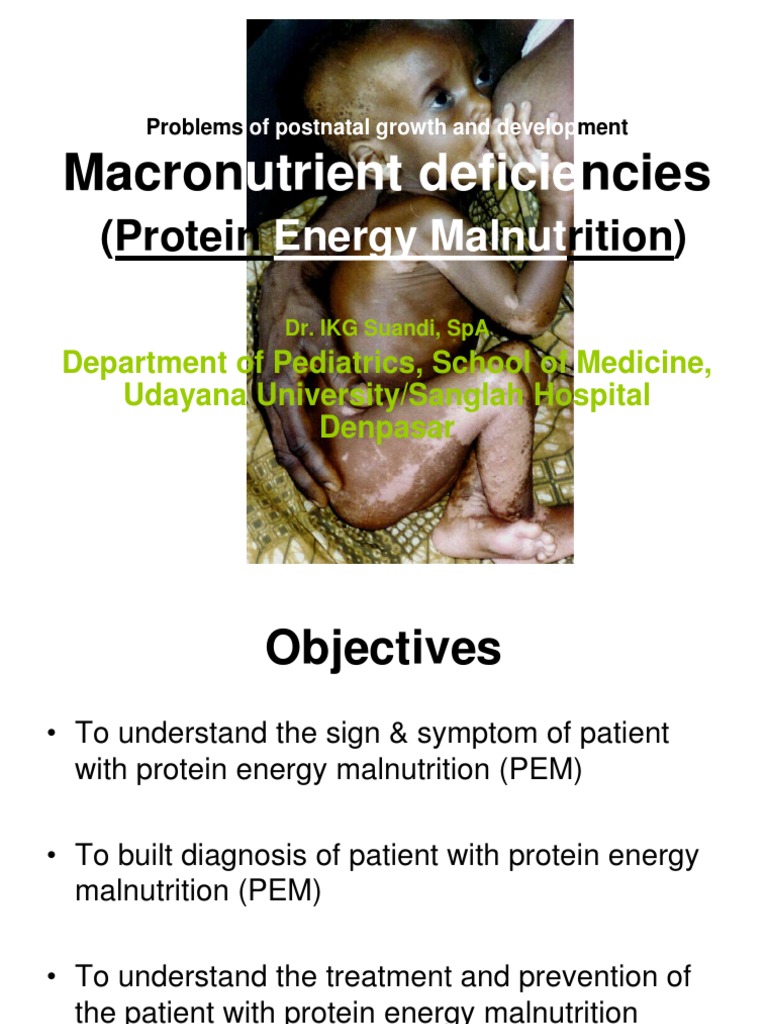 Understanding Protein Energy Malnutrition | PDF | Malnutrition | Metabolism