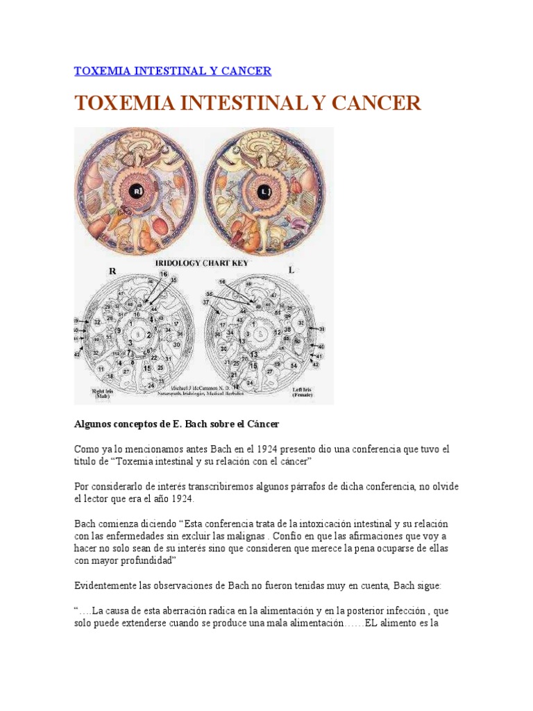 Toxemia Intestinal y Cancer | PDF | Septicemia | Cáncer