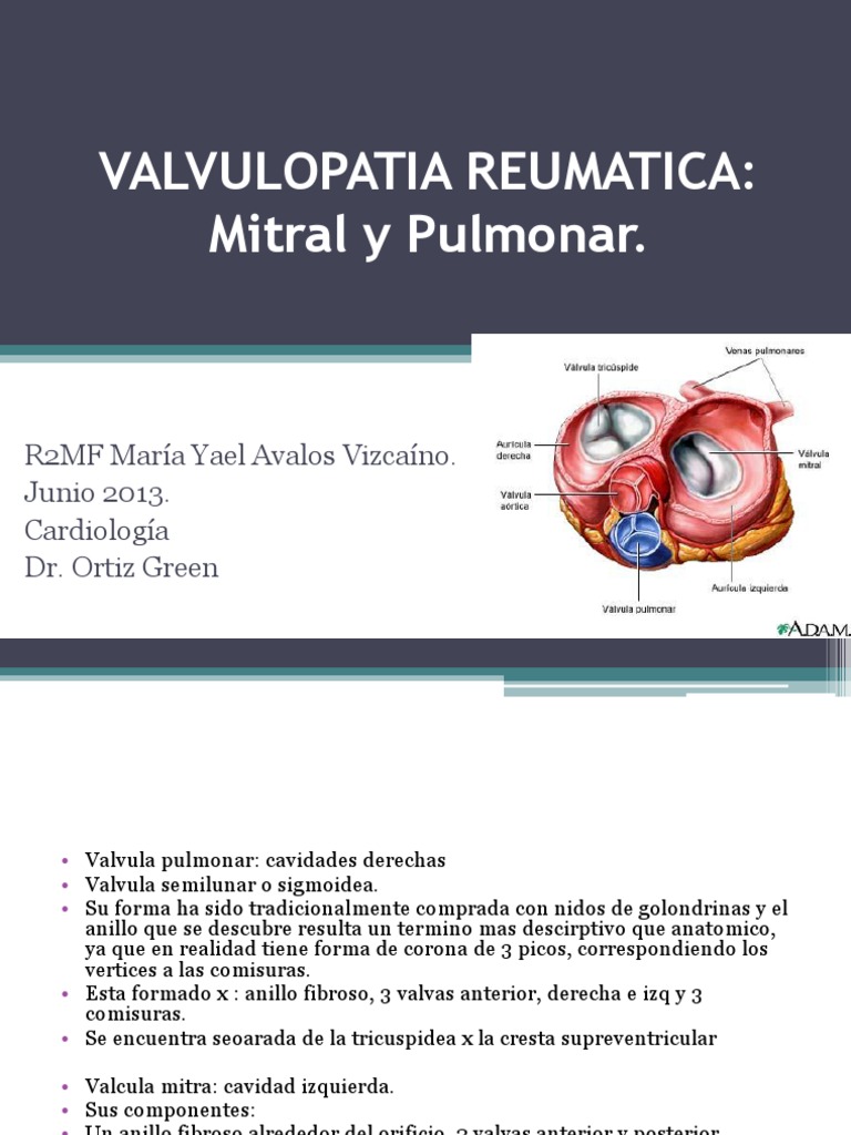 VALVULOPATIA REUMATICA | Enfermedades cardiovasculares | Corazón