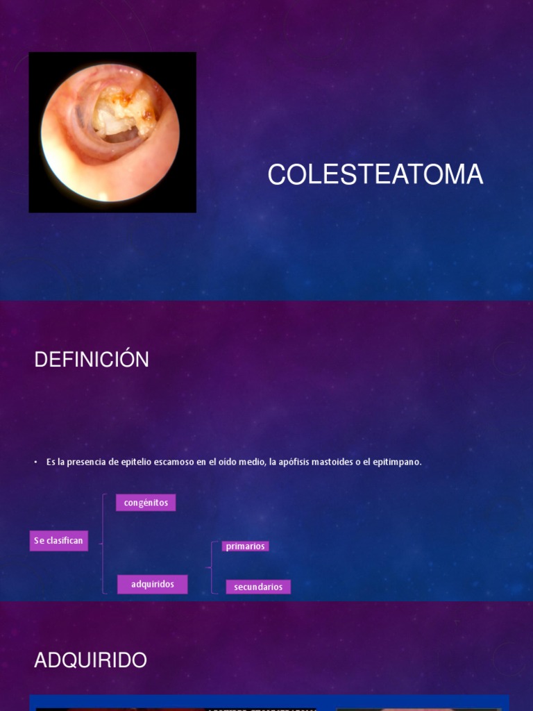 Colesteatoma: Diagnóstico y Tratamiento | PDF | Oído | Cirugía